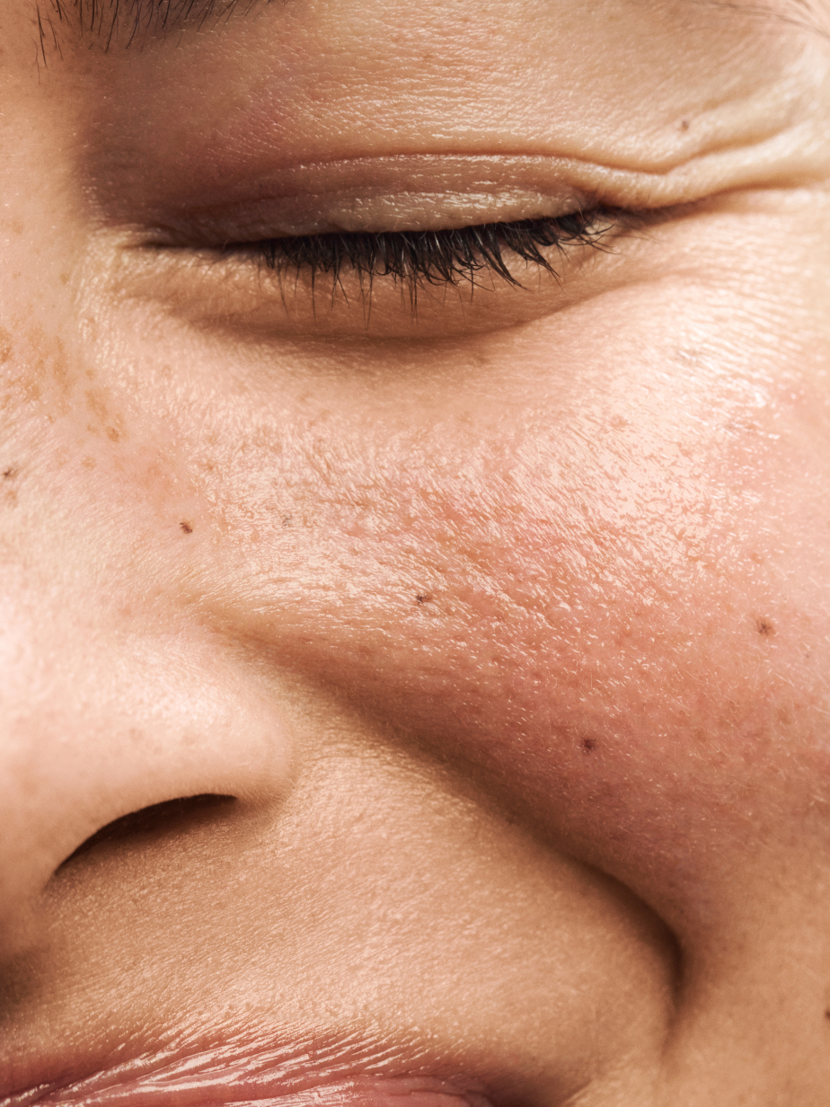 How To Reduce And Prevent Pigmentation | The MECCA Memo